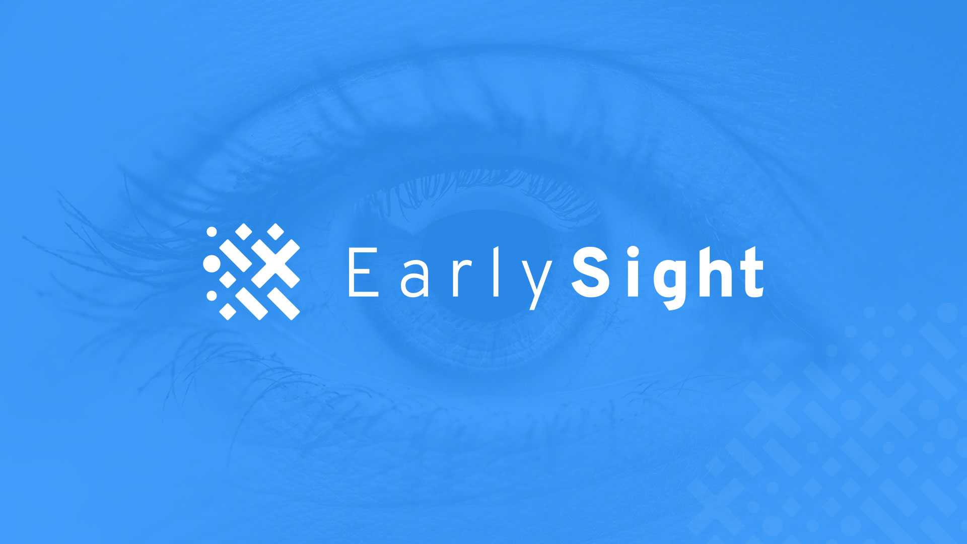 In Vivo Retinal Pigment Epithelium Imaging using Transscleral Optical ...
